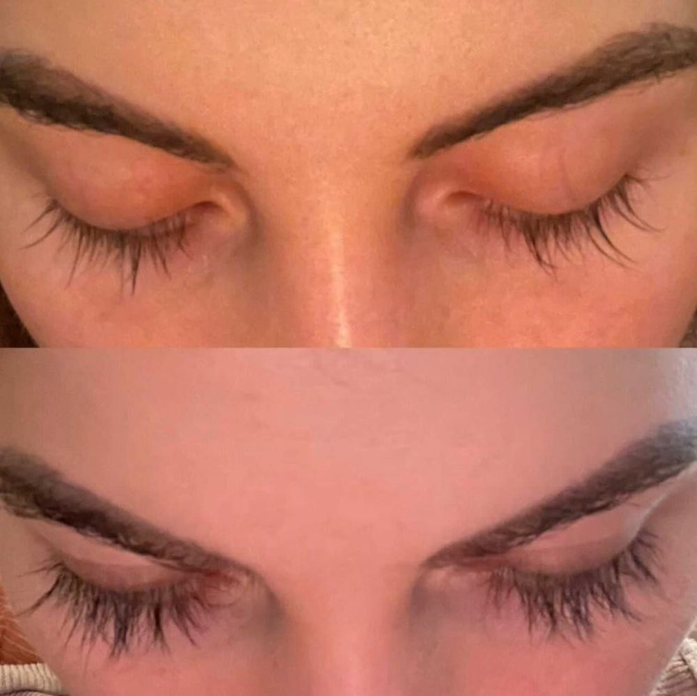 Before and After – RapidLash UK